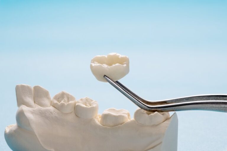 Check Crown Light! 5 Signs Your Dental Crown Needs to Be Replaced